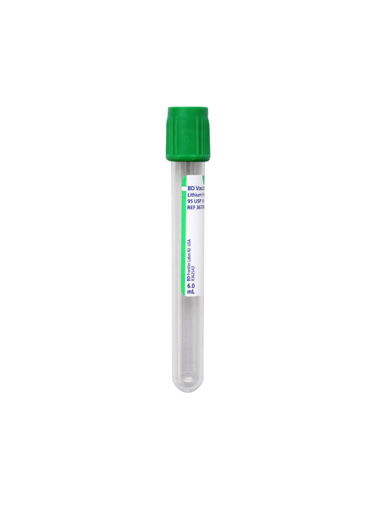 prostate-specific-antigen-psa-reference-range-update