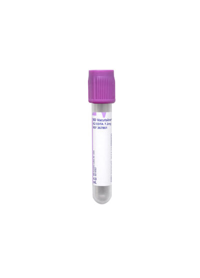 Histocompatibility & Immunogenetics | Cleveland Clinic Laboratories