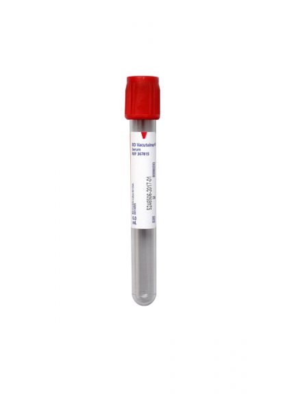 Histocompatibility & Immunogenetics | Cleveland Clinic Laboratories