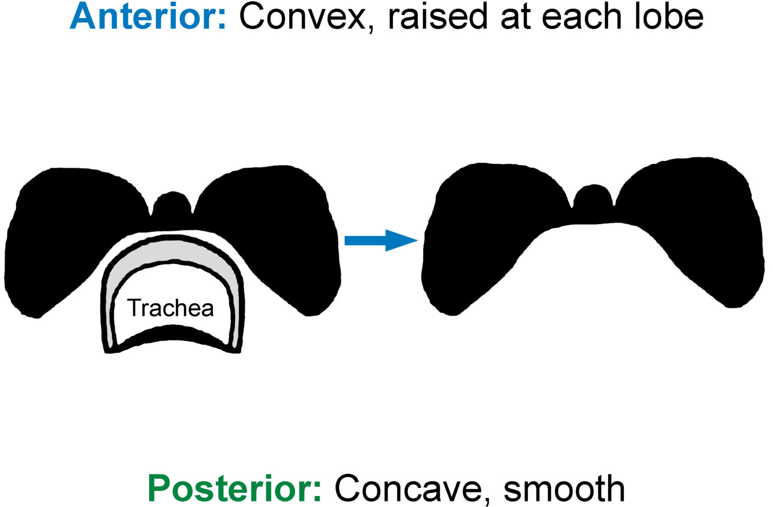 Thyroid Grossing Guidelines | Cleveland Clinic Laboratories